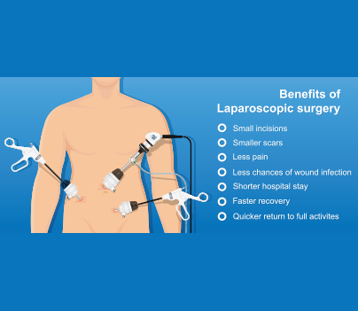 Laparoscopic Inguinal Hernia Surgery | Treatment & Risks